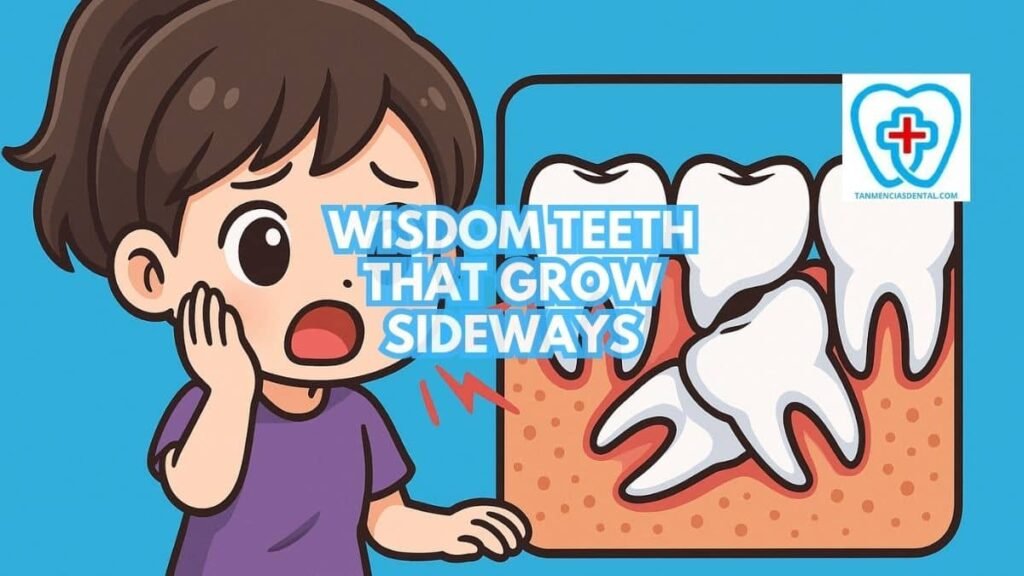 Why Wisdom Teeth That Grow Sideways Cause Discomfort